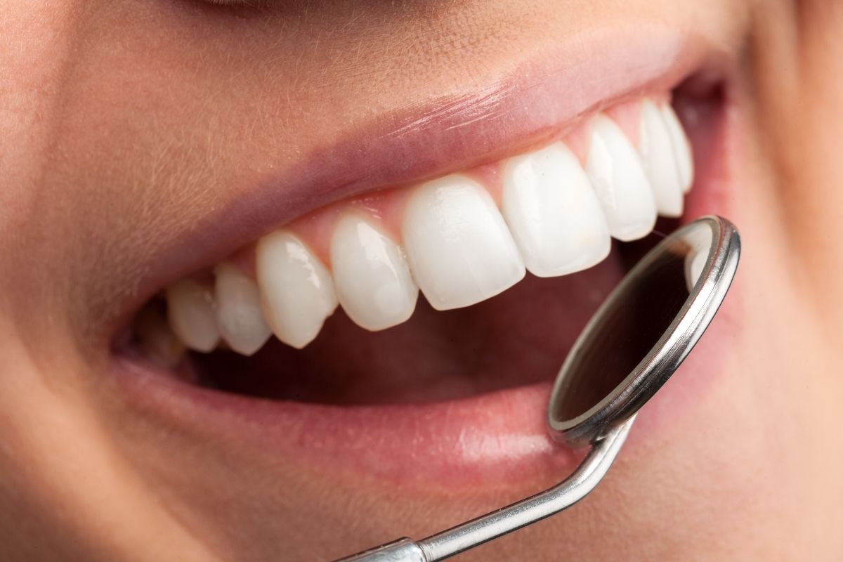 Parodontite: sintomi, prevenzione e come curarla - Dental Arca