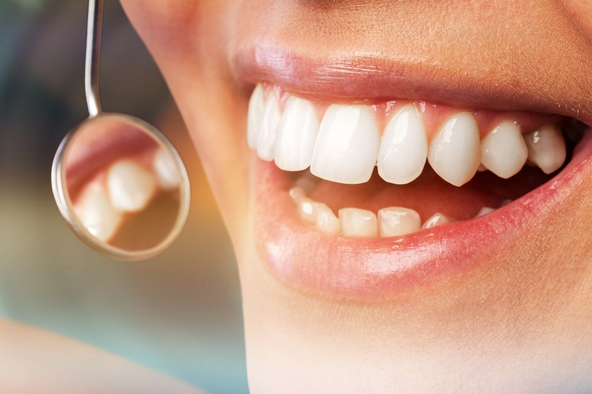 Parodontite e piorrea, cause e differenze - Dental Arca