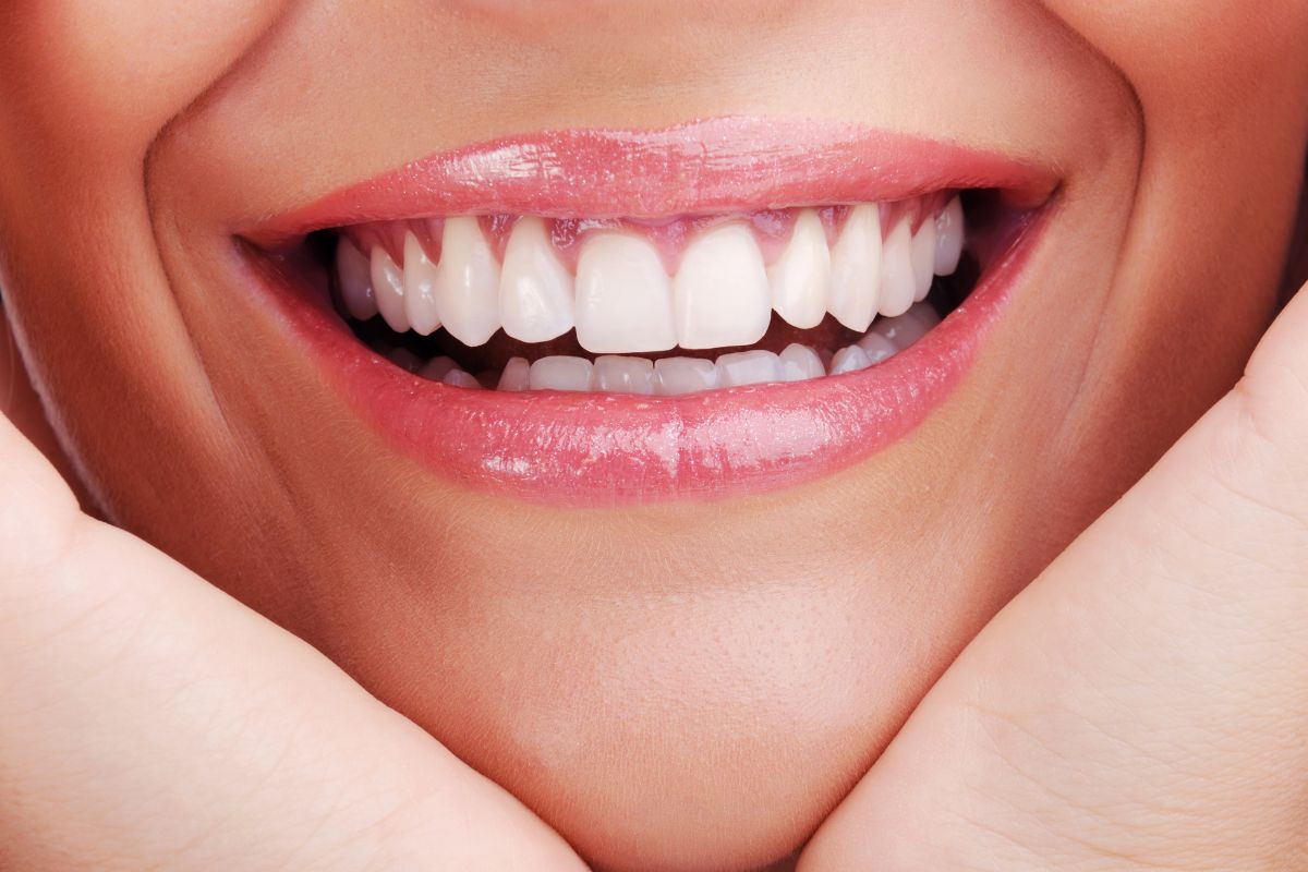 Correggere il Morso Aperto: Cause, Trattamenti e Soluzioni - Dental Arca